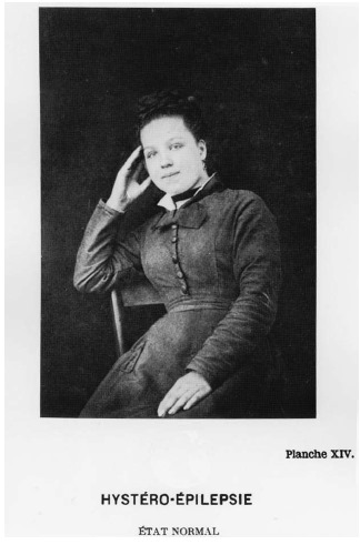 Documento e espetáculo: Charcot e a invenção da histeria